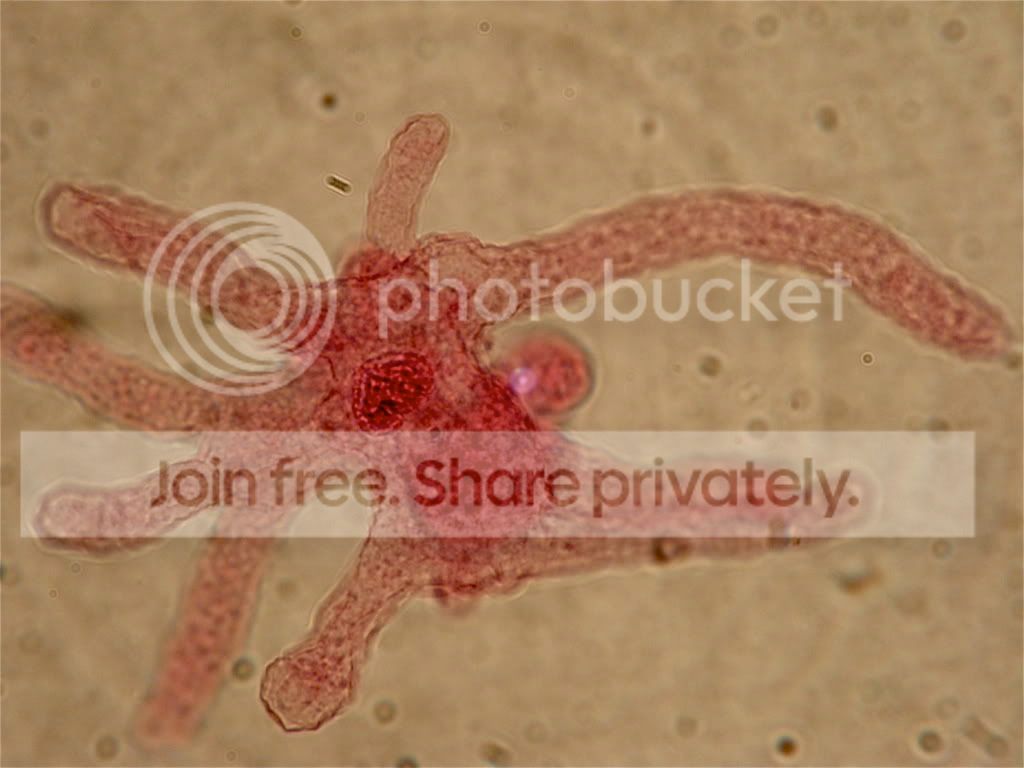 Amoeba 400x Magnification